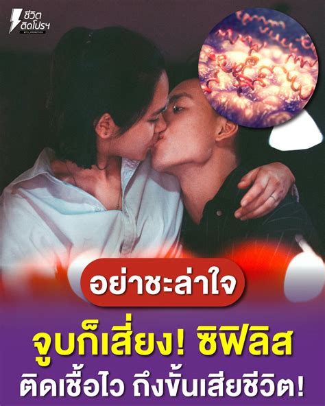 ชีวิตติดโปรฯ แค่จูบปากกัน เสี่ยง “ซิฟิลิส” โรคเงียบที่อันตรายถึงชีวิต 💋🦠 ใครว่า Oral Sex