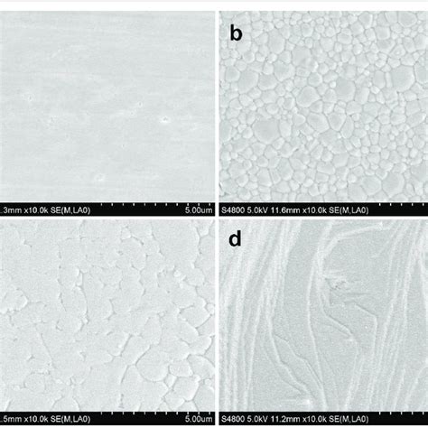 Virtual Construction Of Customized Bracket Modeling A Digital Modeling