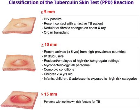 Reasons For Positive Tb Test