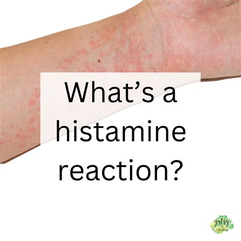 What Is A Histamine Reaction — Gutsy By Nutrition Health And Wellness