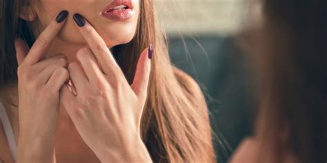 Not All Acne Is The Same How To Identify The Different Types Dermamode