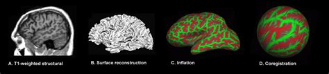 Surface Based Morphometry Encyclopedia Article Citizendium Surface Based Morphometry Encyclopedia Article Citizendium