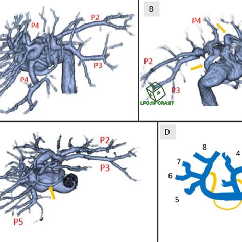 A C Volume Rendering 3d Reconstruction Of Computed Tomography Focused Download Scientific