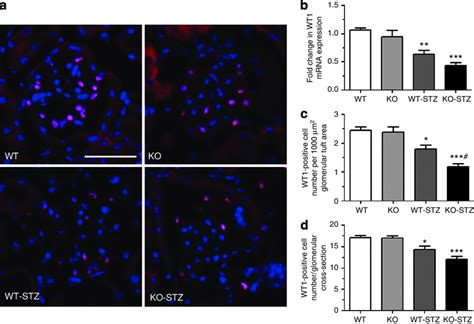 Glomerular Podocyte Number Is Reduced In Ko Stz Mice A The