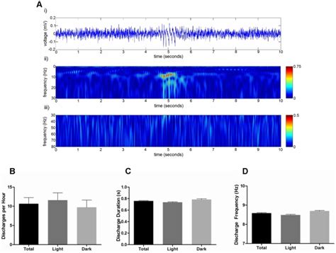 Panel A Representative Example Of A Second Segment Of Raw EEG Download Scientific Diagram