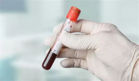 Антимюлеров хормон тълкуване на нивата му за забременяването Ezine Bg