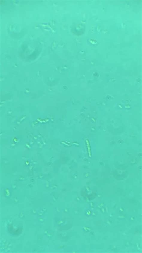 Smaller Bacteria On Spiral Bacteria In Center Rmicroscopy