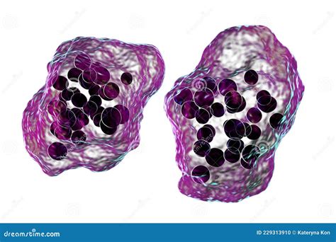 Giant Multinucleated Cells Stock Illustration 229314223