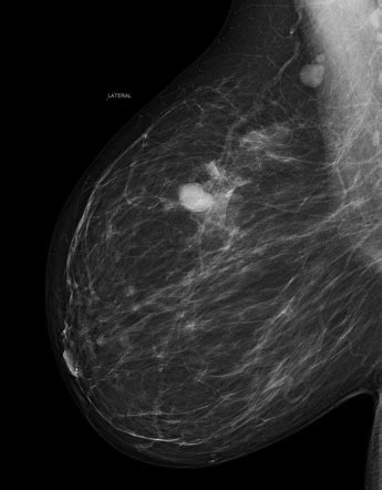 Image Radiopaedia Org