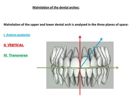Classification Of Occlusion And Malocclusion Dr Nabil Al Zubair Pdf