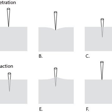 Different Stages Of Needle Movement During Penetration And Retraction Download Scientific Diagram