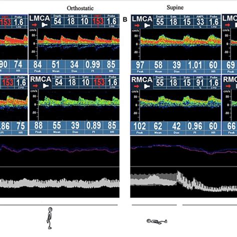 Example Of Simultaneous Monitoring Of Non Invasive Continuous Blood Download Scientific