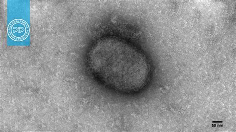 رنگ ‌آمیزی منفی ویروس‌ها چگونه است و کاربرد آن چیست؟ مجله پل ایده‌آل پارس