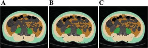 Example Illustrating Results Of Fully Automatic And Semi‐automatic Download Scientific Diagram