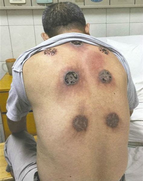 【閲覧注意】中国のマッサージ店に1か月行き続けた結果・・・ ポッカキットポッカキット