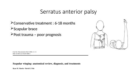 Scapular Dyskinesis Types And Management Pptx