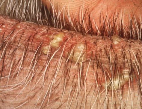 Is Puppy Pyoderma Contagious To Humans