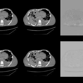 Generation Of Noise Image Download Scientific Diagram
