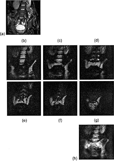Details Of The Segmentation Scheme The Images Are From The Posterior Download Scientific
