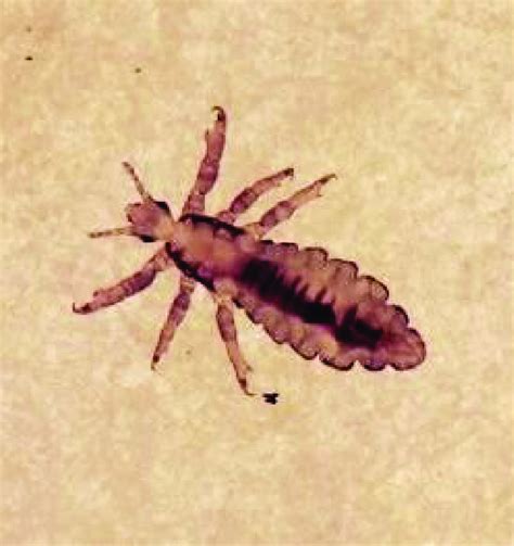 Lice Under Microscope