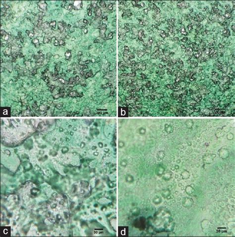 Bacterial Bioprinting On A Flexible Substrate For Fabrication Of A Colorimetric Temperature