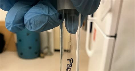 Punctiform Bacteria Colonies