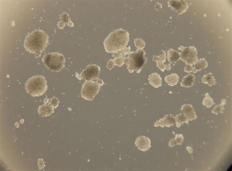 Human Islet Isolation Procedure Human Islet Transplant Laboratory