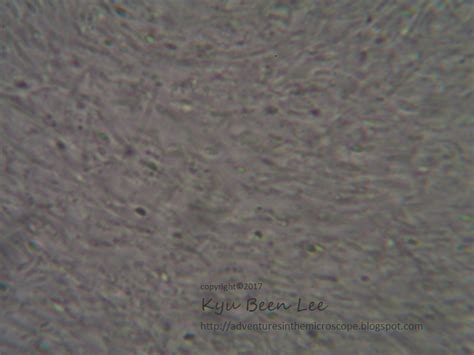 Micro World What Is Bacillus Subtilis Natto