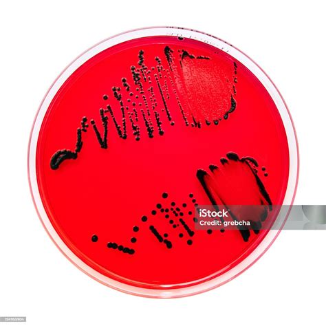 1 Salmonella Spp On Xld Agar Download Scientific Diagram Salmonella