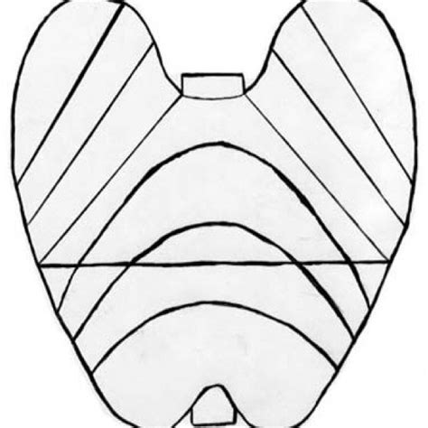 Classification Of An Endoscopically Evident Atrophic Pattern The Download Scientific Diagram