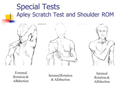 Shoulder Abduction Test