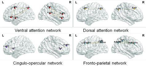 Visualization Of Systems 1 Ventral And Dorsal Attention Upper Row Download Scientific