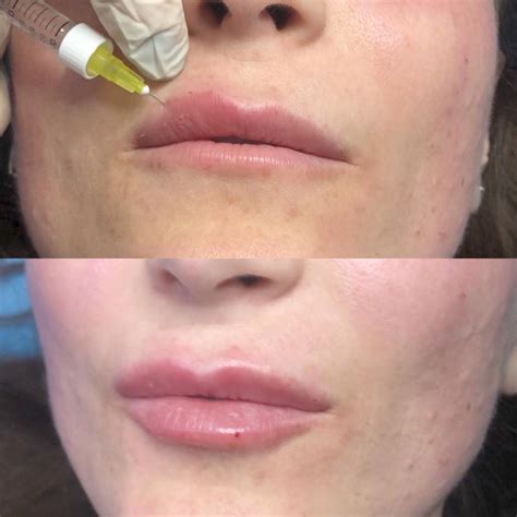 სილამაზის სალონი სილამაზის სალონი ლიმა Beauty Salon Lima