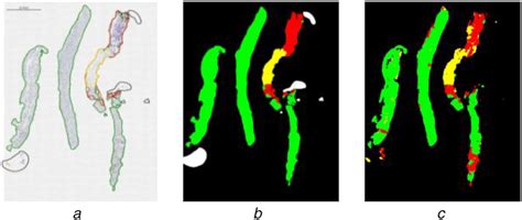 example of cd‐unet segmentation output of a cd8 ki67 image from the