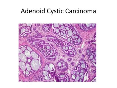 Histological Pattern Pptx Is Histology Patterns Ppt