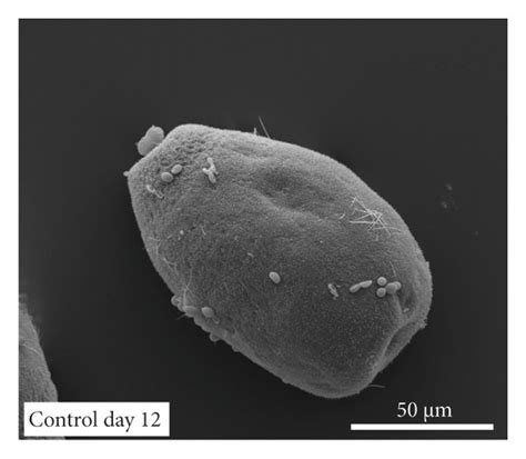 Images At Scanning Electron Microscope Of E Granulosus S S