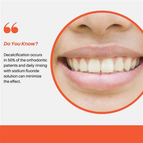 15 Reasons Not To Get Braces Top Side Effects Explained