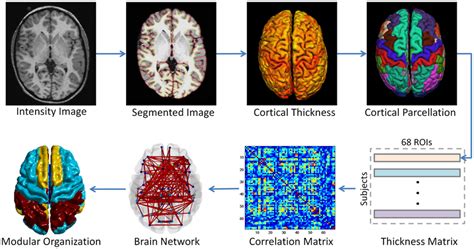 Flowchart For The Construction Of Structural Cortical Network For Each