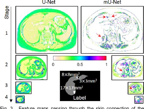 Figure 3 From Modified U Net Mu Net With Incorporation Of Object