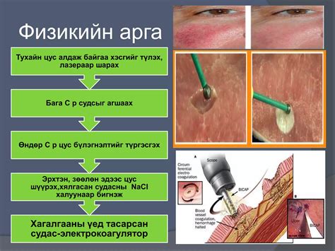 цус алдалтыг тогтоох Pptx