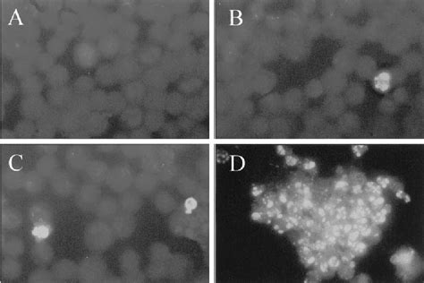 Figure 2 From Apoptosis In Bcrabl Expressing Human Leukemia Cells