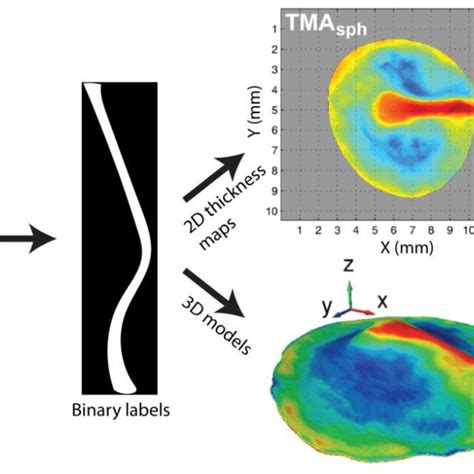 Post Processing Pipeline Raw 2d Oct Data Are Segmented Into Binary