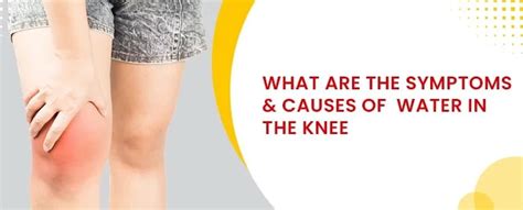 What Are The Symptoms And Causes Of Water In The Knee Germanten Hospital