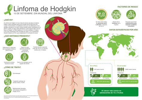 Cancer Linfoma Hodgkin Sintomas Hpv Treatment Of Abnormal Cells My