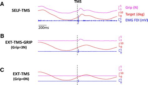 Representative Tms Trials By The Same Subject During Rightward Target