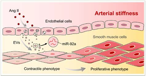 内皮来源的细胞外 Microrna 92a 通过调节血管平滑肌细胞的表型变化促进动脉硬化 知乎