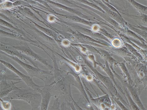 Fibroblasts In Culture