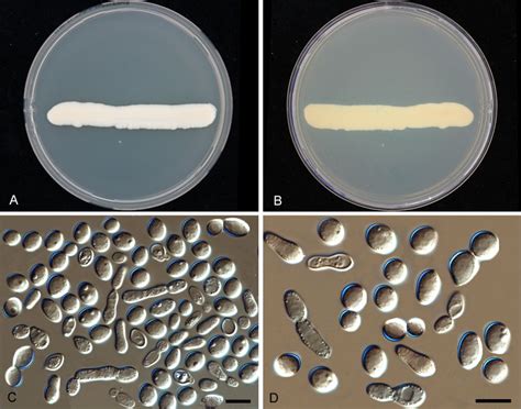 Cryptococcus Uzbekistanensis Cbs 8683 800px Atlas Of Clinical Fungi