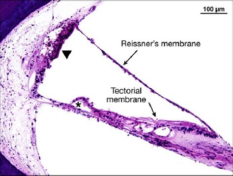 Tectorial Membrane Histology