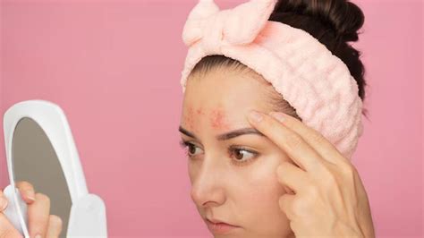 शेविंग के बाद पिंपल्स से बचने के उपाय How To Prevent Face Pimples After Shaving In Hindi How
